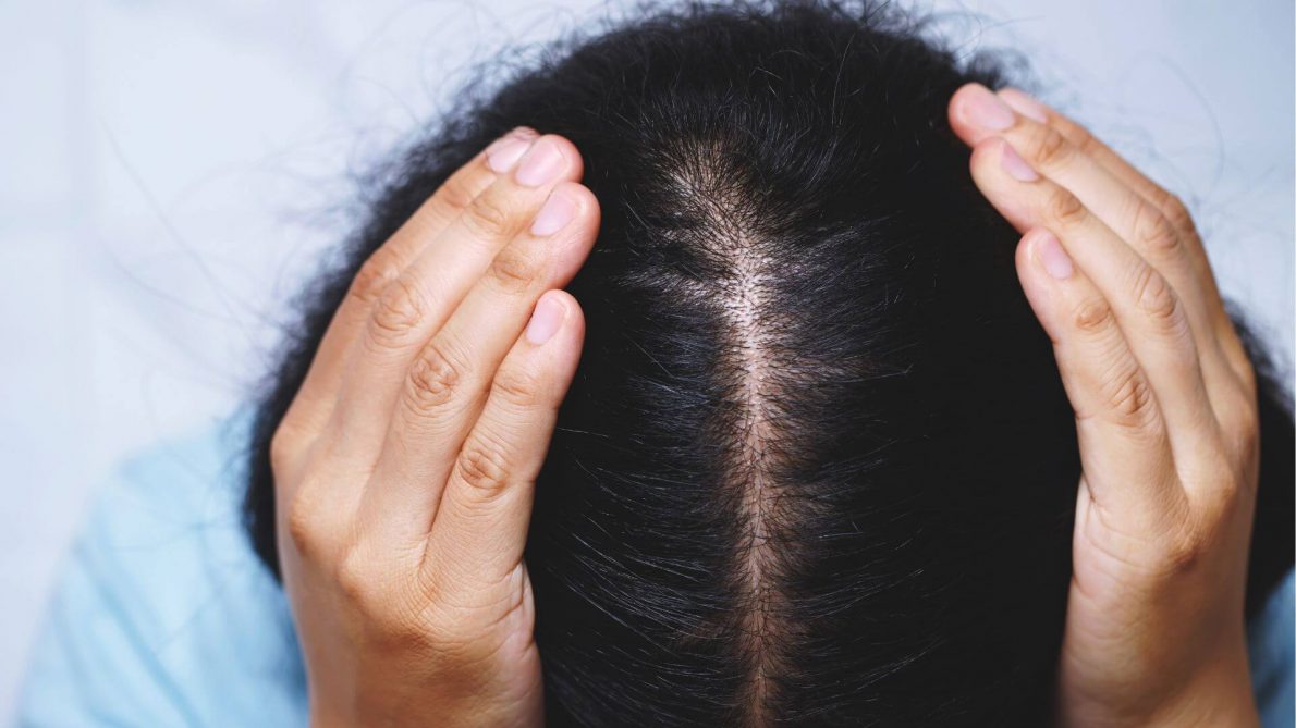 Vitamin Rambut yang Wajib Anda Ketahui - Suplint